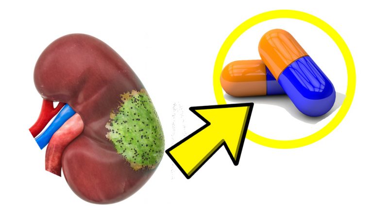 NHFKP | A new hope for kidney patients!